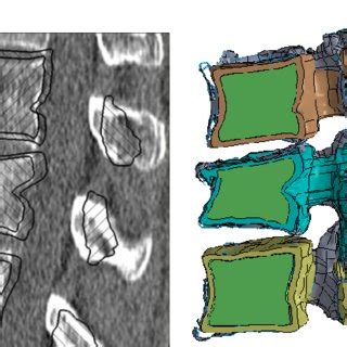 Overlapping CAD Model Sections And CT Scans Download Scientific Diagram