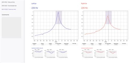 How To Interpret A Tympanogram Amplivox