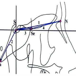 Angular Measurements Download Scientific Diagram