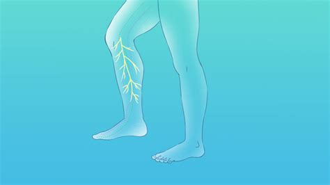 脚麻 腿痛 小腿 医疗图片素材 高清图片素材