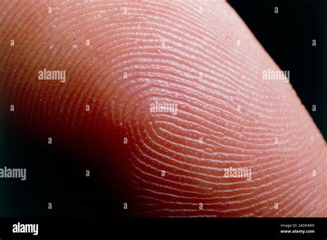 Macrophotograph Of The Index Finger Of A Young Male Human Showing