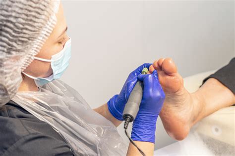 전문 하드웨어 페디큐어 Podiatrist의 약속에서 의료 페디큐어 절차 중 환자 2명에 대한 스톡 사진 및 기타 이미지 2명 30 34세 건강관리와 의술 Istock