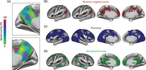 A Spatial Overlay Map Of Posteromedial Cortex Functional Subdivisions