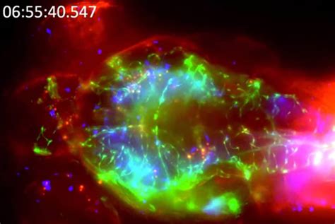 Cryptococcus Meningitis News Research Tags Articles Neuroscience News