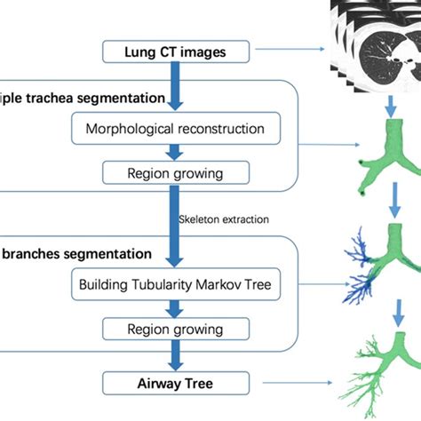 The Block Diagram Of Segmentation Framework Download Scientific Diagram
