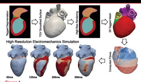 Figure 1 From A Personalised Approach To Computational Heart Modelling Semantic Scholar