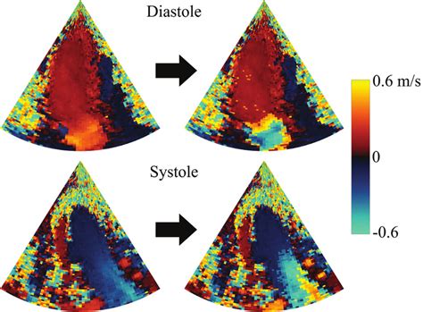 Generation Of Synthetic Images With Artificial Aliasing Artifacts Download Scientific Diagram