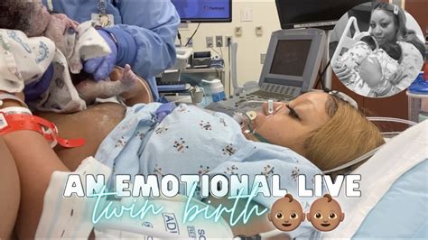 The Live Birth Of Our Second Set Of Twins Real Raw And Emotional