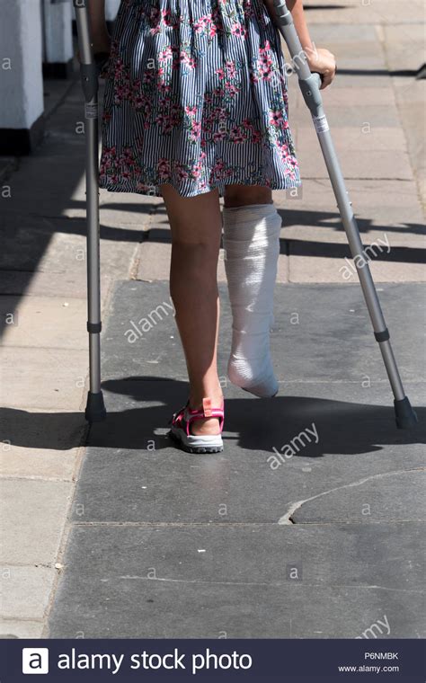 Broken Leg Cast Amputee