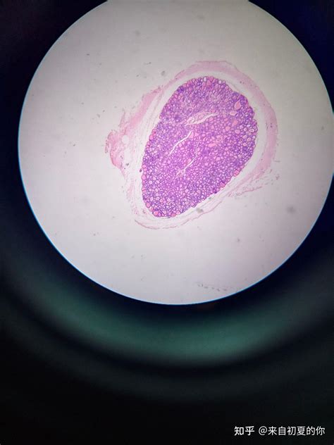 组织胚胎学的切片考试，显微镜下辨别器官，你能知道几个？它们的特征性结构是什么？ 知乎