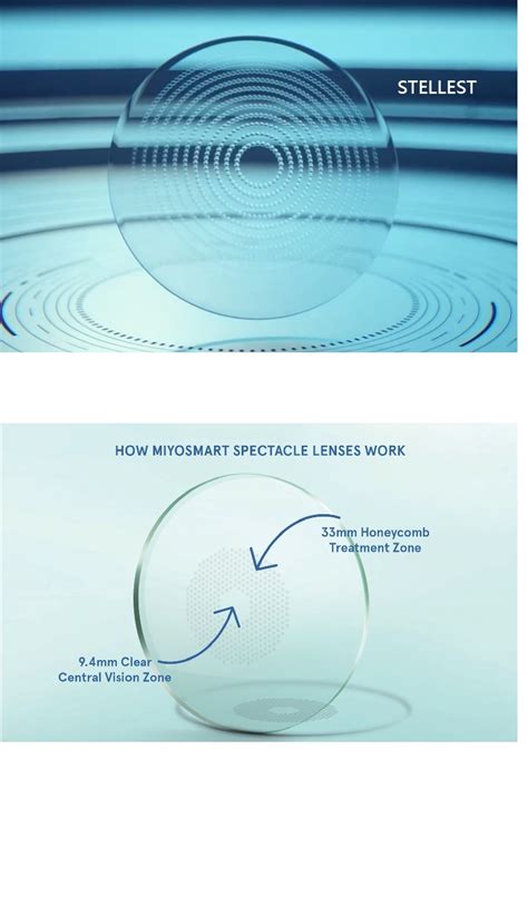 Myopia Control Glasses Cataract And Refractive Surgeon Singapore Dr
