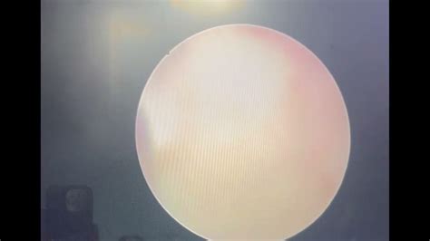 Hysteroscopic Resection Of Submucosal Fibroid Youtube