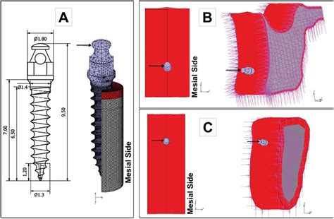 Boundary Conditions Of The Finite Element Models A Mesial Load Was