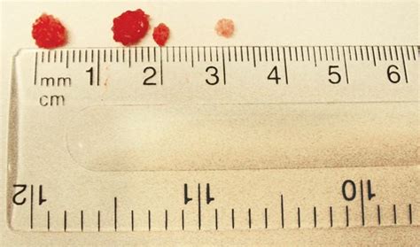 Feline Idiopathic Cystitisfic