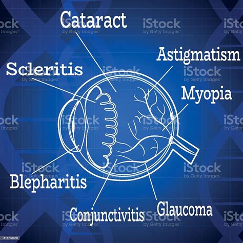 Human Eye Diseases 3 Stock Illustration Download Image Now Anatomy