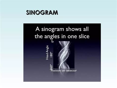 Spect Single Photon Emission Computed Tomography Ppt