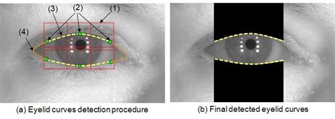 Vasirs Eyelid Curves Detection Using Linear Hough Transform And Download Scientific Diagram