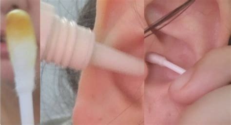 Abigaillatina Ear Wax Removal With Qtips Closeup ManyVids