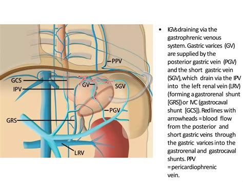 Collaterals In Phtn Pptx