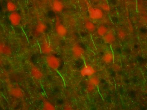 臨床病理検討会が開催されます ニュース 新潟大学脳研究所 脳神経内科