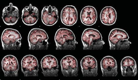 3 Example Of An Inspection Image That Is Generated In The Iris