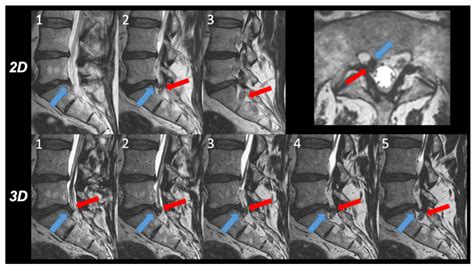 Tomography Free Full Text High Resolution 3d Versus Standard