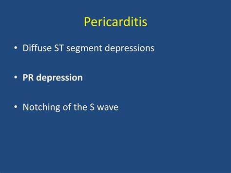 Ppt Ecgs Powerpoint Presentation Free Download Id3701177