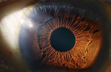 The Iris Anatomy Function And Treatment