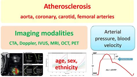 Sex Differences In Diagnostic Modalities Of Atherosclerosis In The Macrocirculation