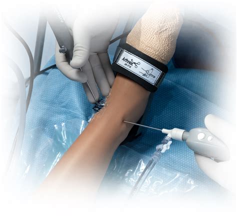 Arthrex Nano Arthroscopy