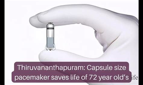 Capsule Size Pacemaker Saves Life Of 72 Year Olds Life