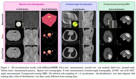 【cvpr 2023的aigc应用汇总 6 】医学图像相关，diffusion扩散 Gan生成对抗网络方法 知乎