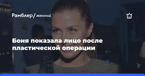 Виктория Боня показала лицо после пластической операции Рамблер женский