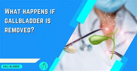 The Effects Of Gallbladder Removal Insights From A Specialist Surgeon In Abu Dhabi