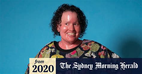 I Want People To See Me Carly Findlay On Rethinking Beauty