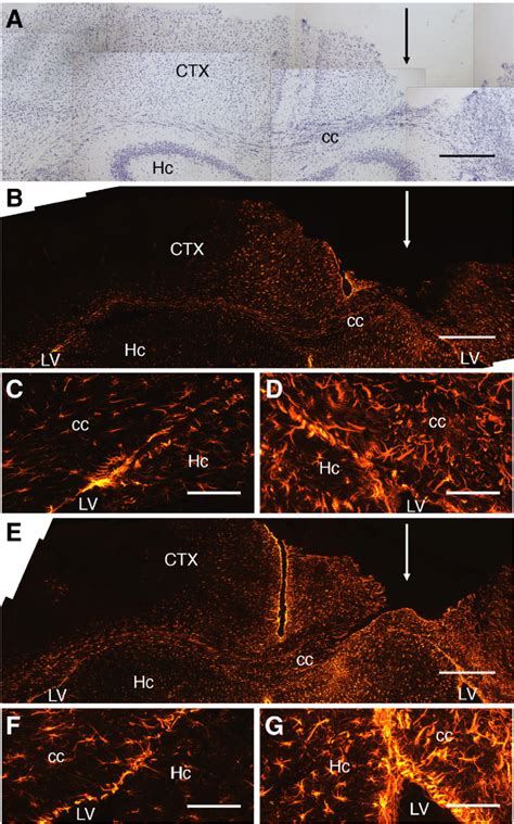 Figure From Global Expression Of Ngf Promotes Sympathetic Axonal
