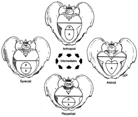 Классификация форм таза Caldwell и Moloy При гинекоидной форме поперечный размер плоскости входа