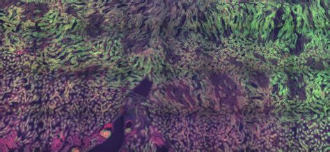 Stitching Images From Your Manual Microscope