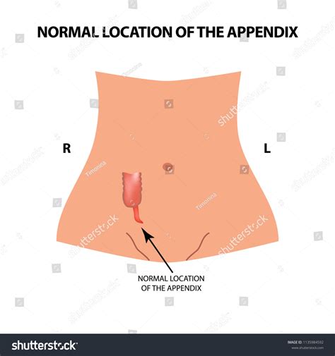 Position Of Appendix Photos Images Pictures Shutterstock