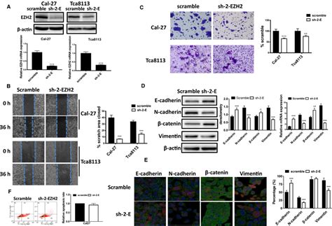 enhancer of zeste homolog 2 ezh2 knockdown inhibits migration