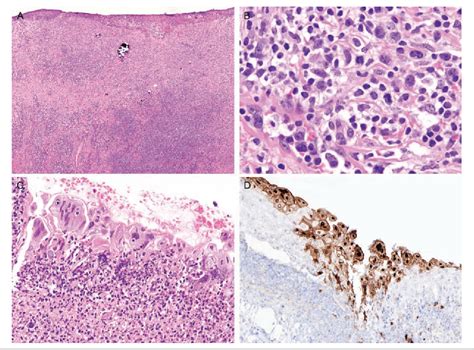 Figure 1 From Nuclear Inclusions And Pseudoinclusions Friends Or Foes