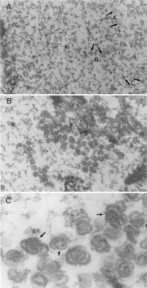 Electron Micrographs Of Thin Sections Of Wt And Prb Virus Infected