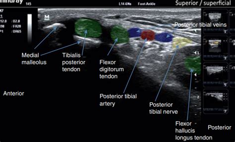 Diagnostic Posterior Tibial Nerve Block Sports Medicine Review