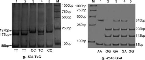 Polymerase Chain Reaction Restriction Fragment Length Polymorphism