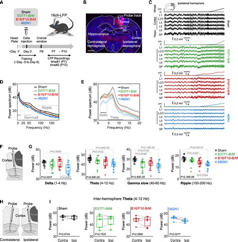 Figure 1 From Machine Learning Identifies Experimental Brain Metastasis