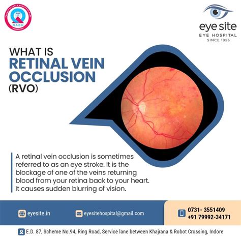 Eyesite Eye Hospital And Retina Centre Indore On Linkedin Eyesiteeyehospital Draanchalagarwal