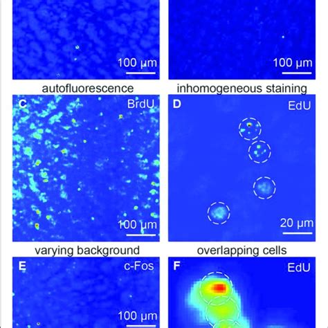 Challenges For The Automatic Algorithms Of Cell Detection Ab