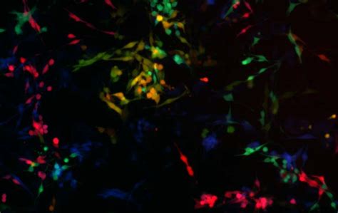 Fluorescent Barcoding Of Cancer Cells Ki Image Awards Archive