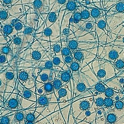 Histoplasma Capsulatum Microbiology Image Microscopic Fungal Cells