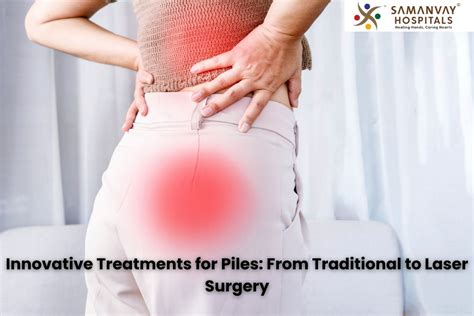 Innovative Piles Treatments Traditional To Laser Surgery